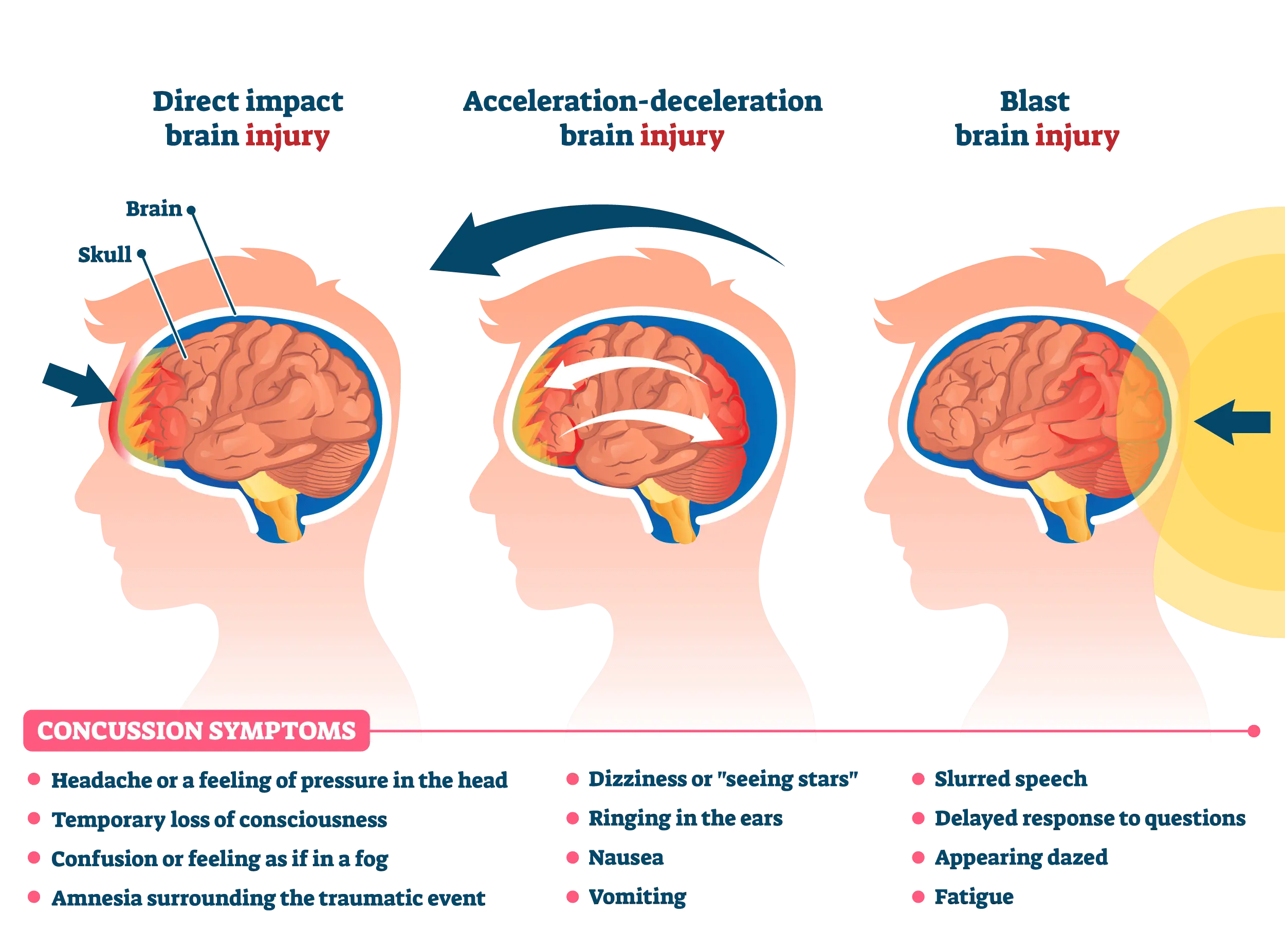 At Home Traumatic Brain Injury Treatment Care | Interim HealthCare